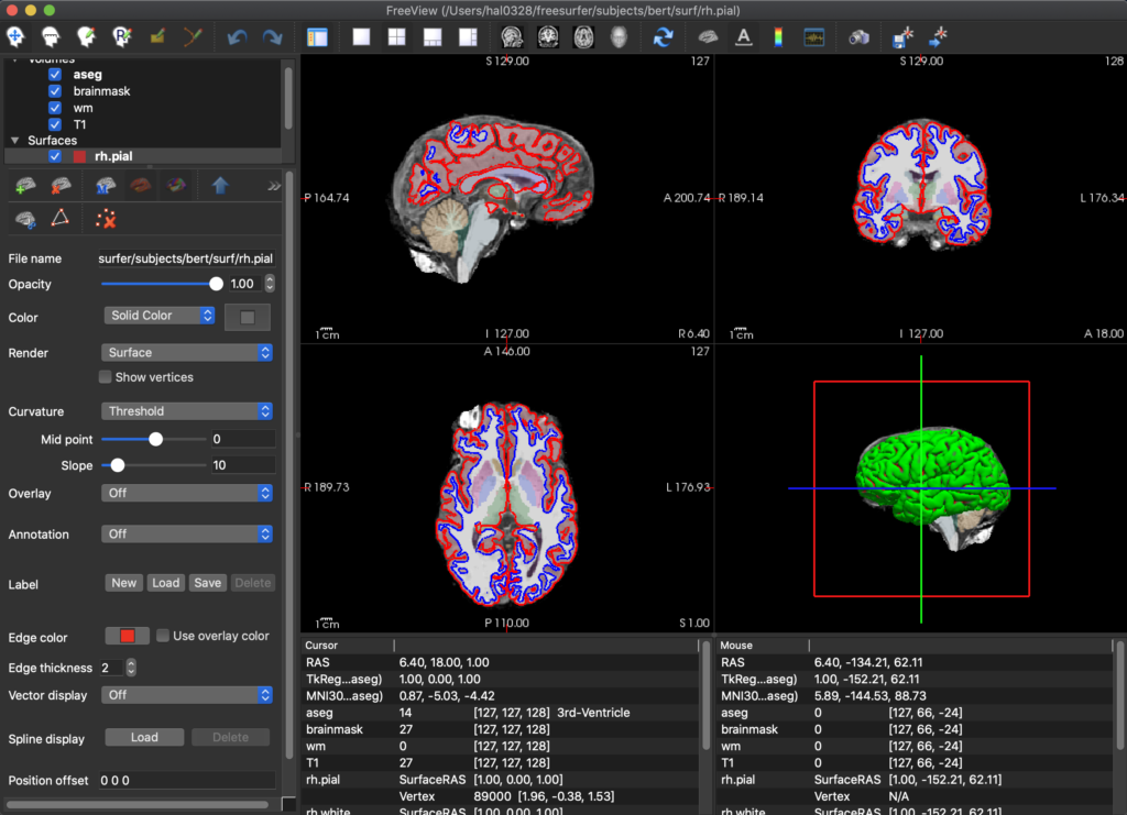 【導入】FreeSurferのインストール方法 | HALnote