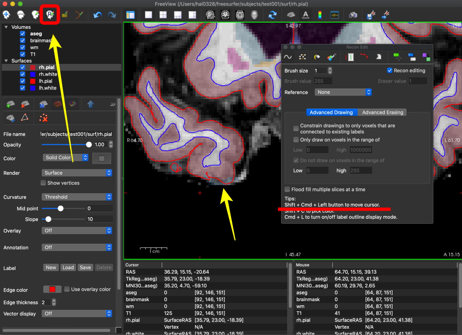 【FreeView】FreeSurferインストール後に行うべきこと #2 | HALnote