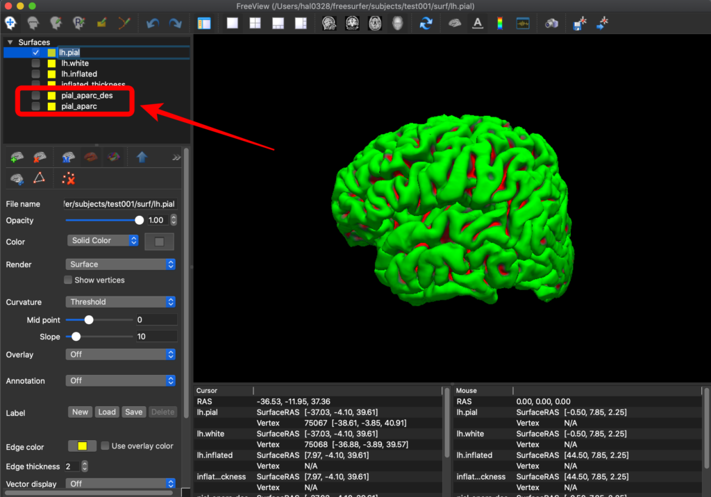 【FreeView】FreeSurferインストール後に行うべきこと #3 | HALnote