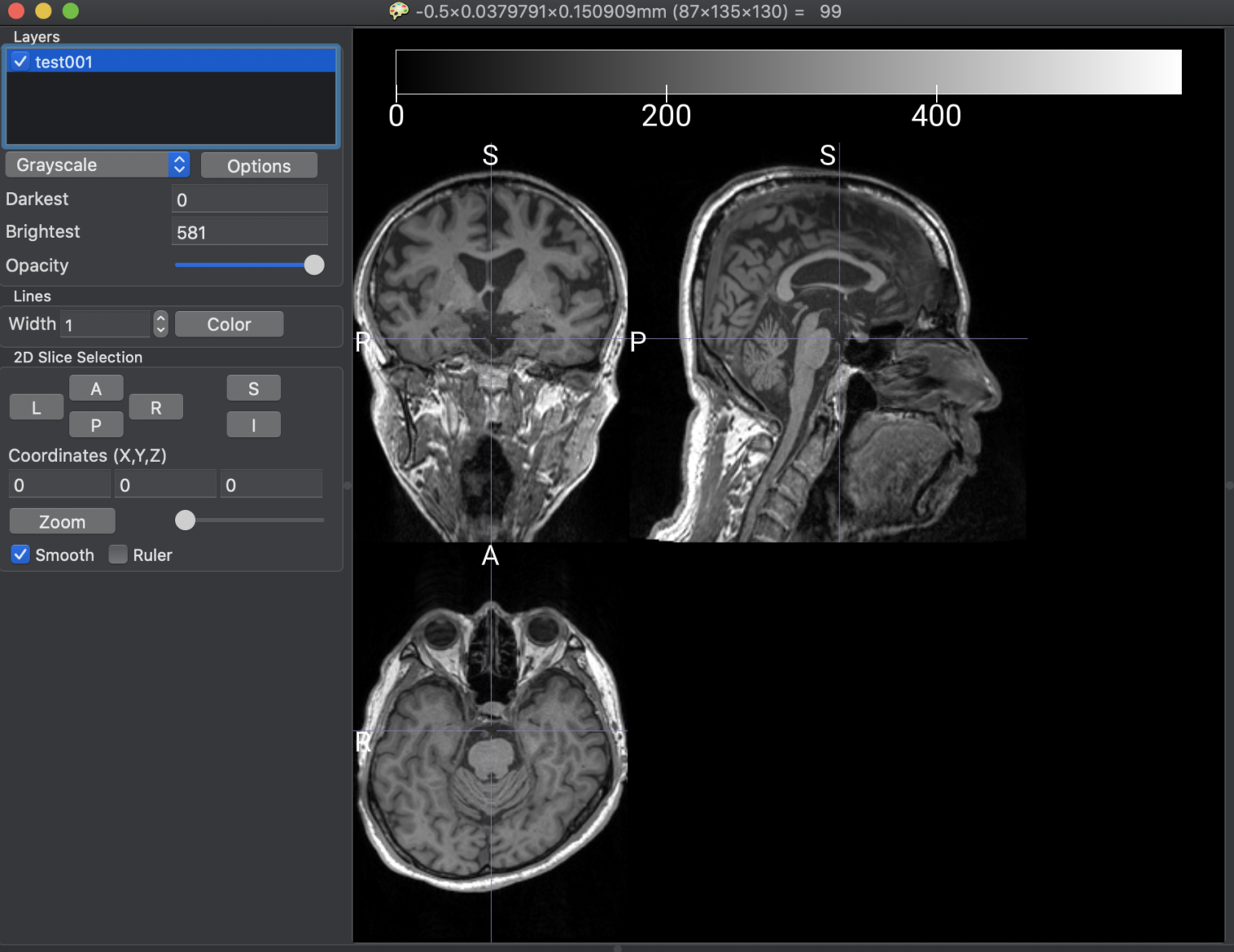 【FreeSurfer】mri_convertを用いた脳画像formatの変換法 | HALnote