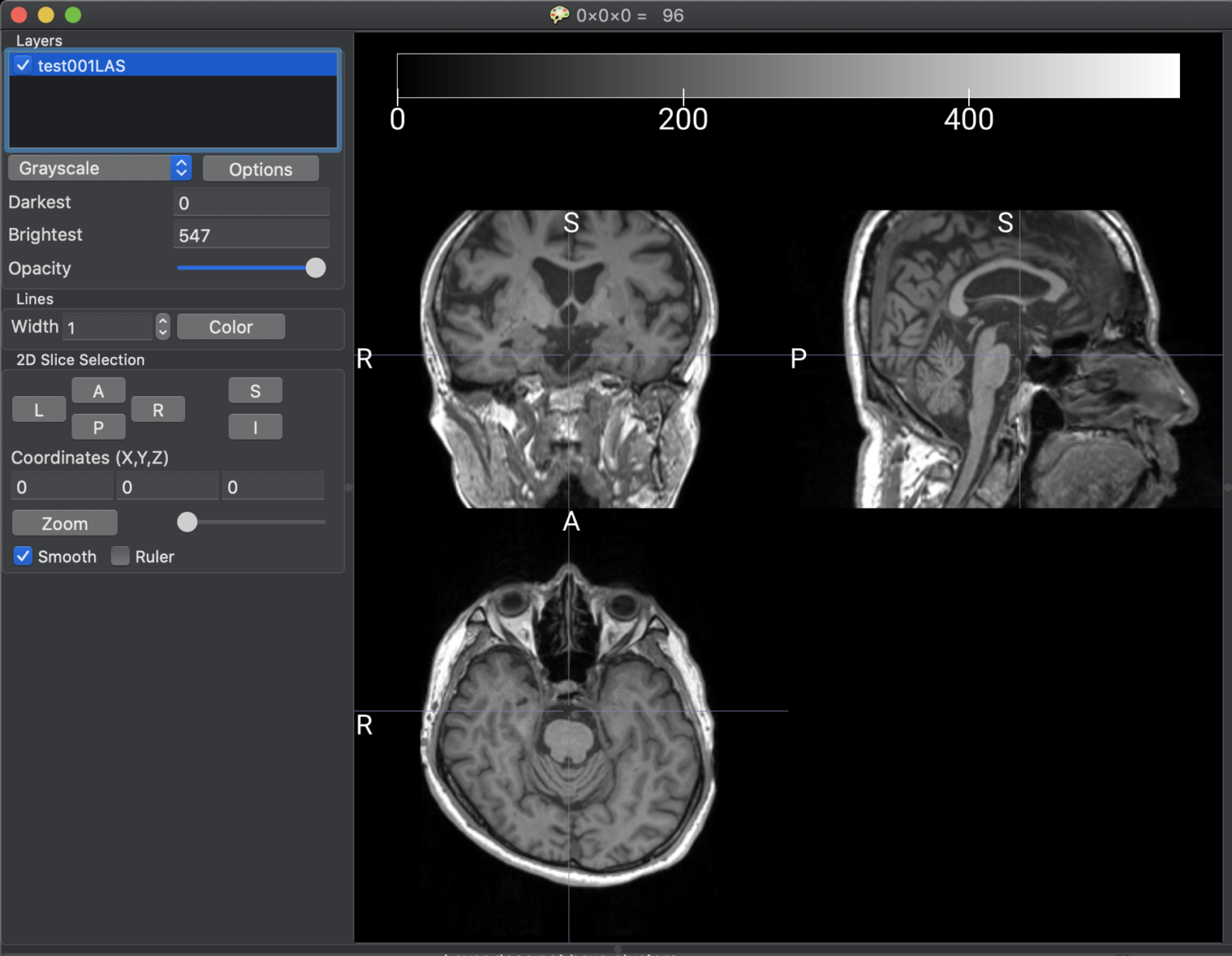 【FreeSurfer】mri_convertを用いた脳画像formatの変換法 | HALnote