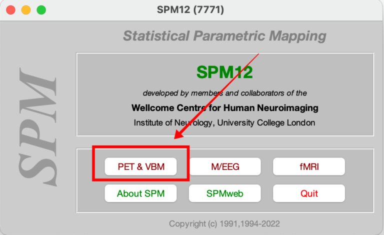SPM拡張ツール”CAT12″の導入方法まとめ | HALnote