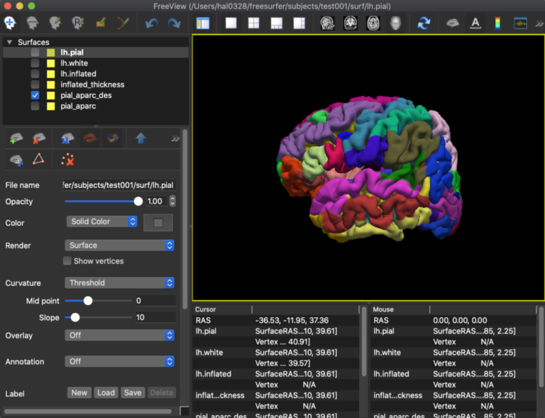 【FreeView】FreeSurferインストール後に行うべきこと #3 | HALnote