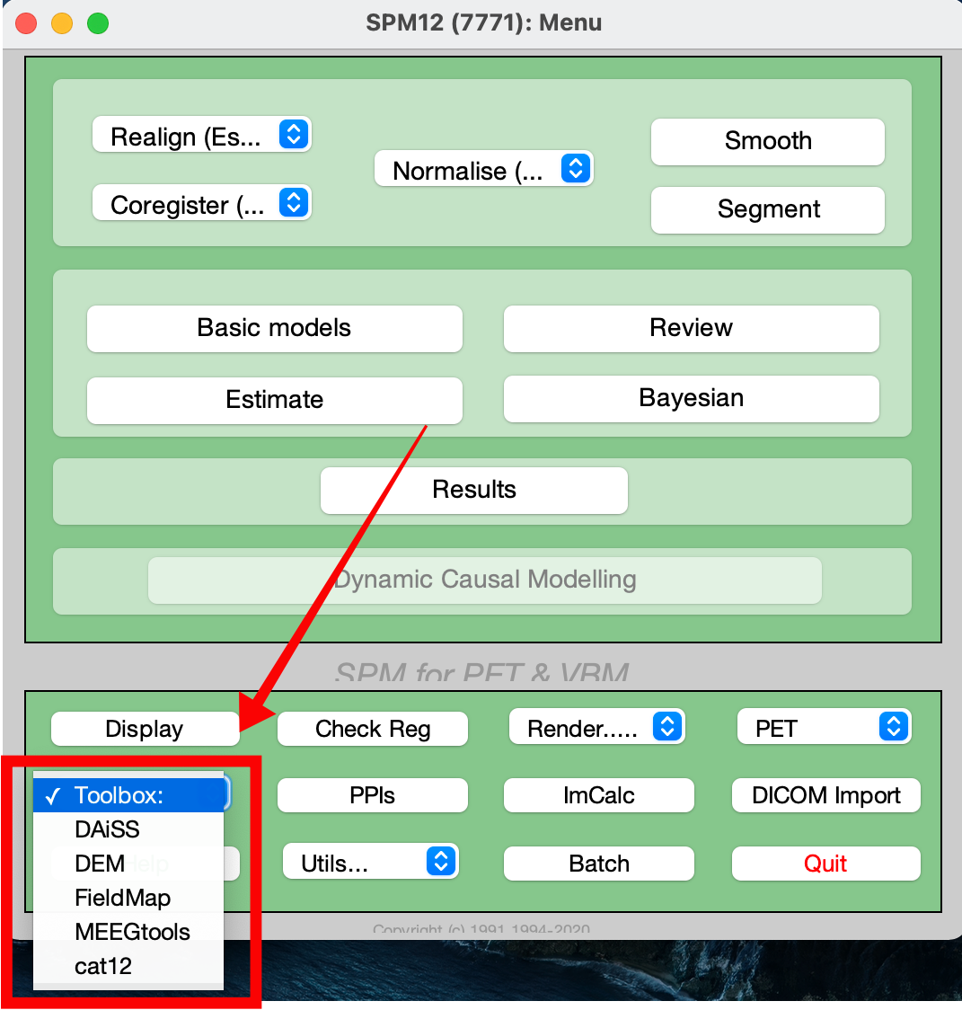 SPM拡張ツール”CAT12″の導入方法まとめ | HALnote