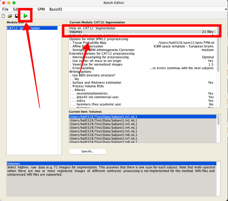 【CAT12】データ前処理の手順・外れ値の評価 | HALnote
