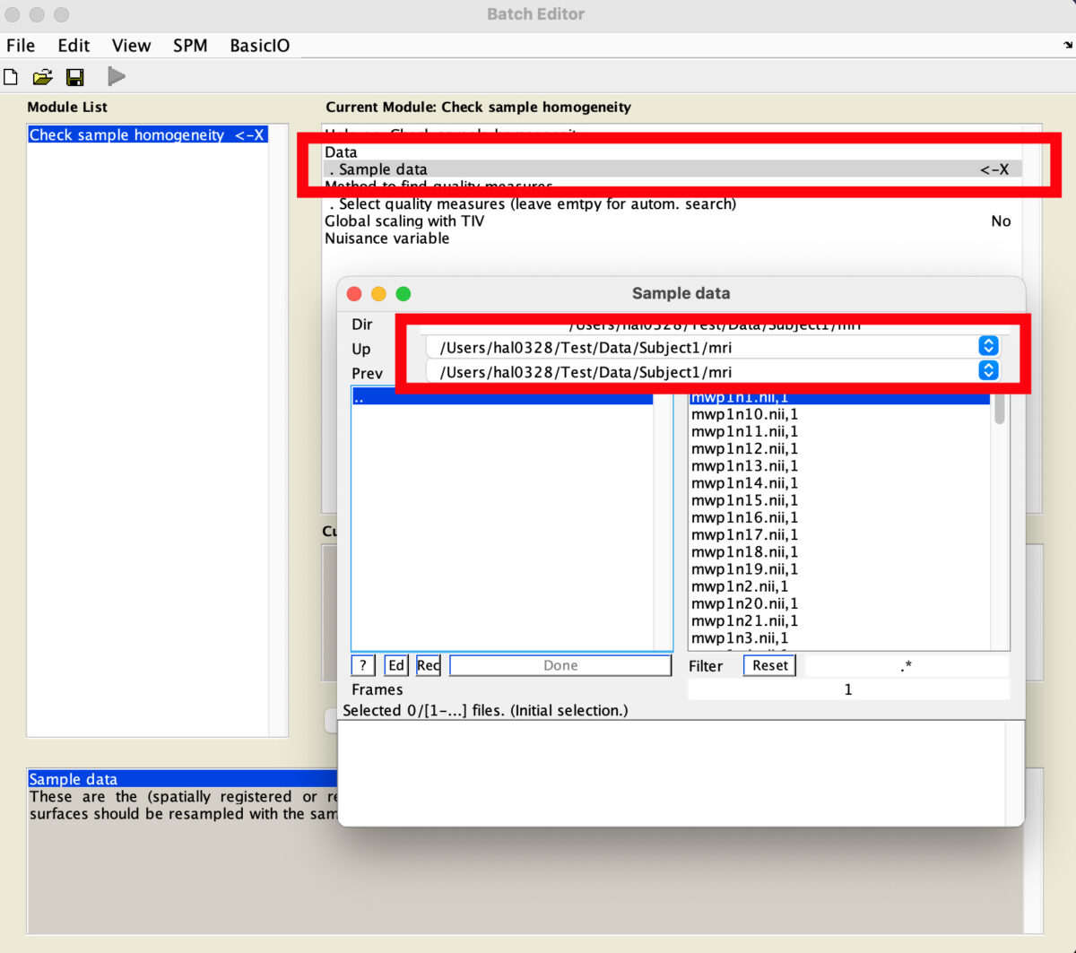 【CAT12】データ前処理の手順・外れ値の評価 | HALnote