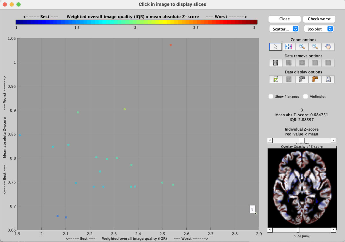 【CAT12】データ前処理の手順・外れ値の評価 | HALnote